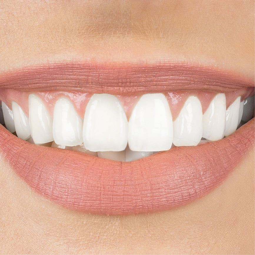 Origin dissolvable teeth whitening strips – OriginWhitening