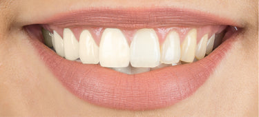 Origin dissolvable teeth whitening strips – OriginWhitening